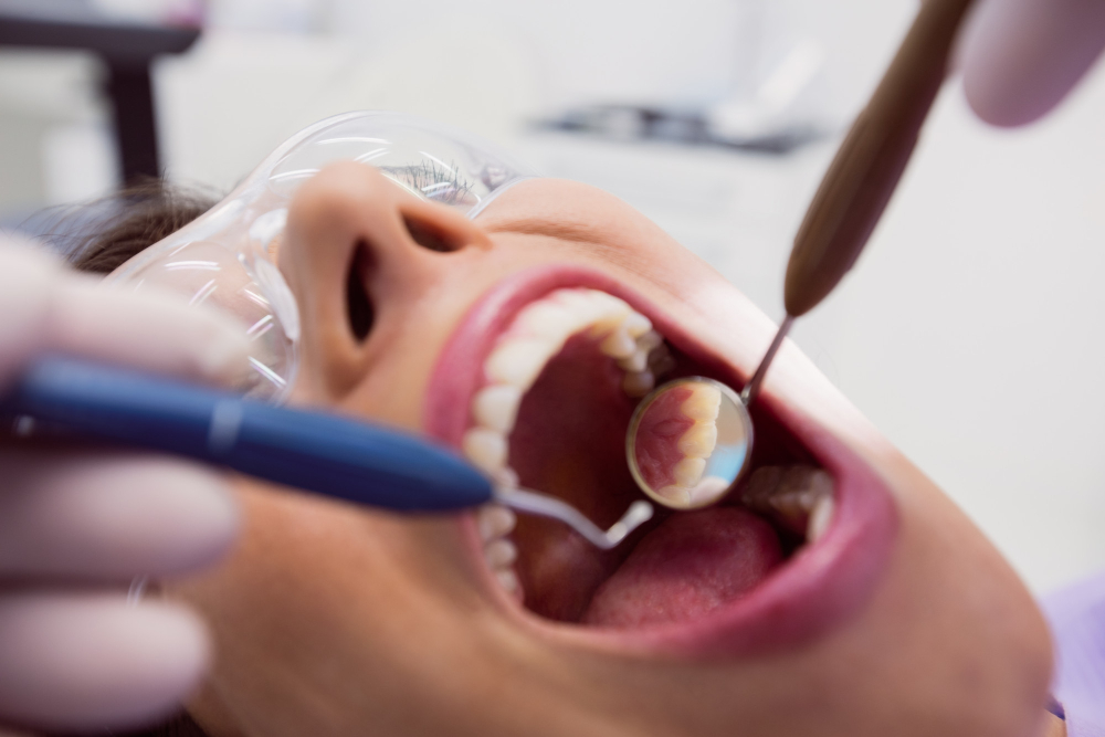 ¿Cuáles son las diferencias entre resinas y amalgamas? - Estética ...
